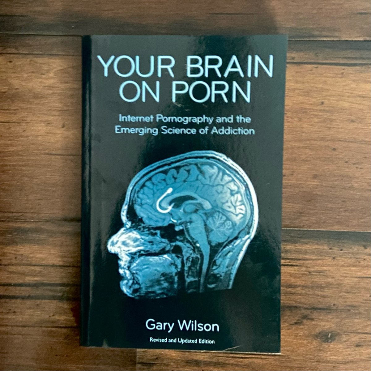 Your Brain on Porn by Gary Wilson, Anthony Jack