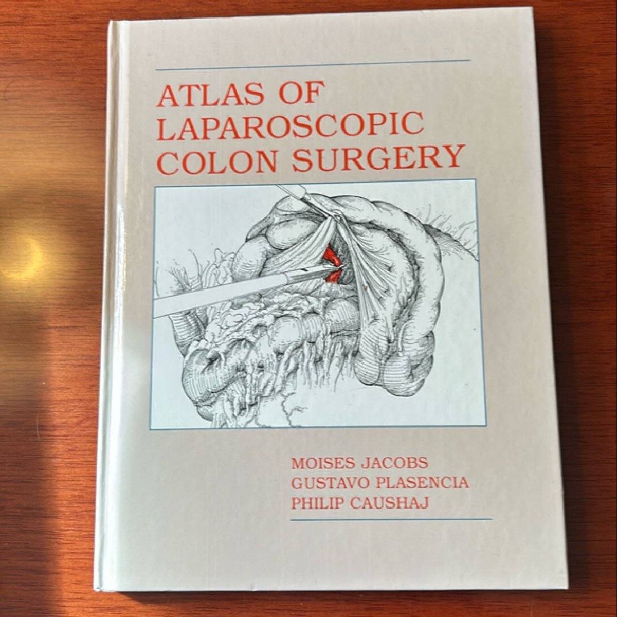 Atlas of Laparoscopic Colon Surgery by Moises Jacobs, Gustavo Plasencia ...